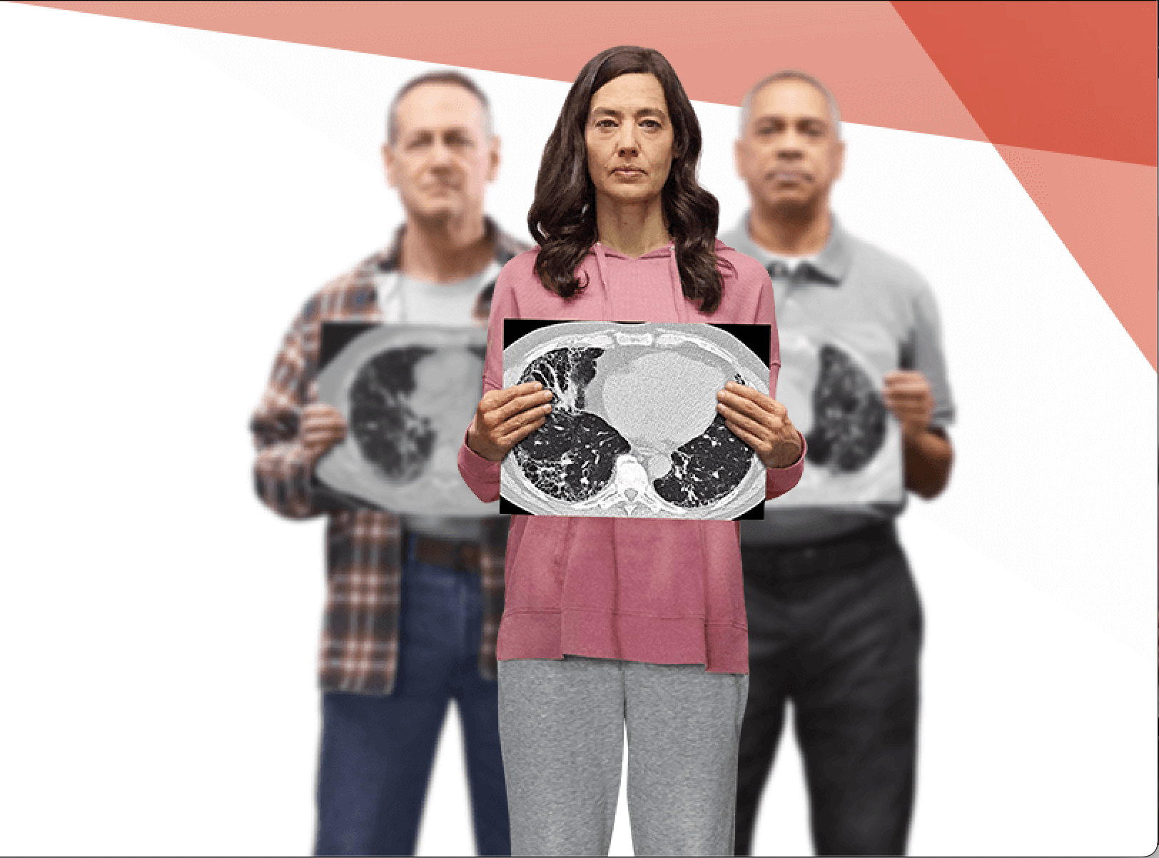 Idiopathic Pulmonary Fibrosis (IPF) | Boehringer Ingelheim